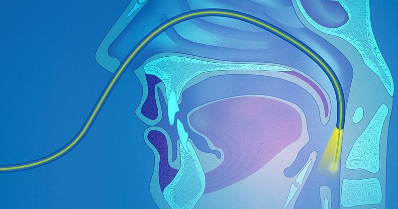 Technique laser ORL - A.R.C. Laser GmbH - Nuremberg